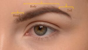 NYC Eyebrow Restoration | New York Eyebrow Hair Transplant | UES